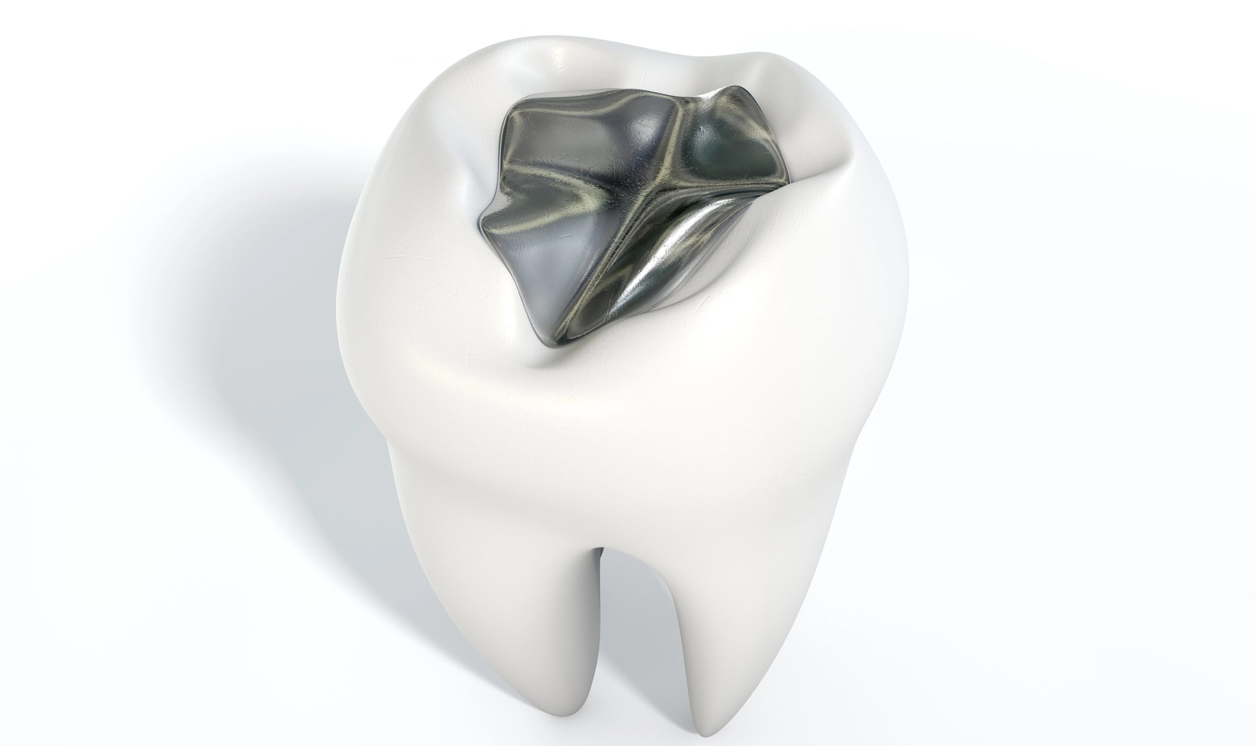 Your Guide to Tooth Fillings in San Gabriel - Renken Dentistry